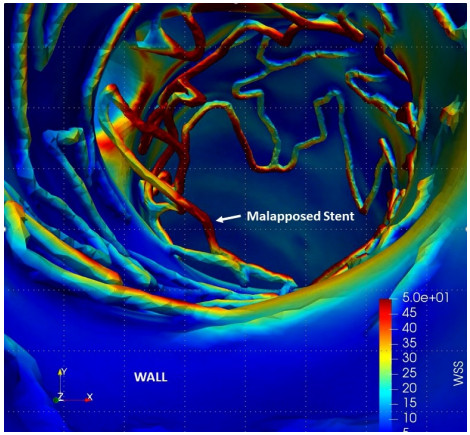 Multi-domain modeling and simulation of blood solutes and elution in ...
