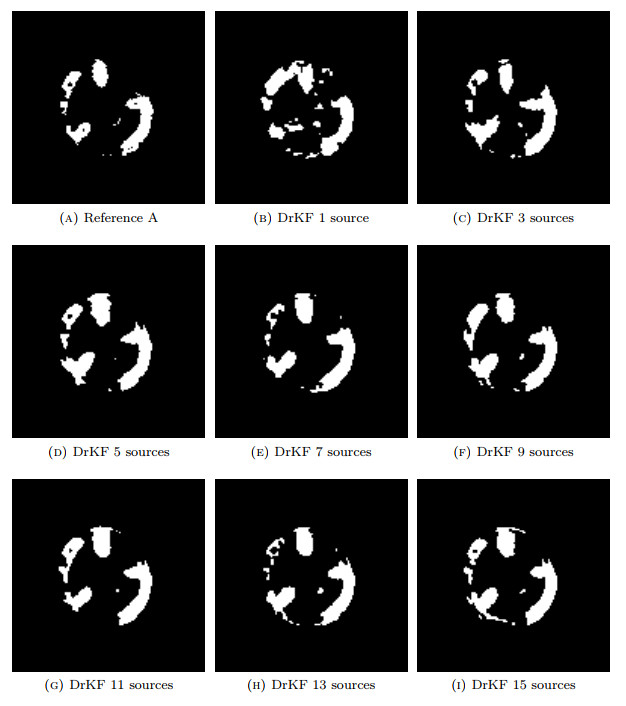Reconstruction and segmentation from sparse sequential X-ray ...