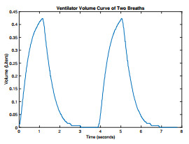 Estimation of airway resistance throughout the bronchial tree from ...