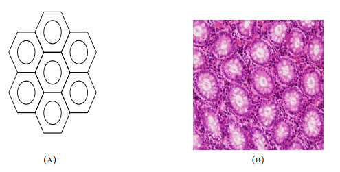 Mathematical model for simulation of morphological changes associated ...