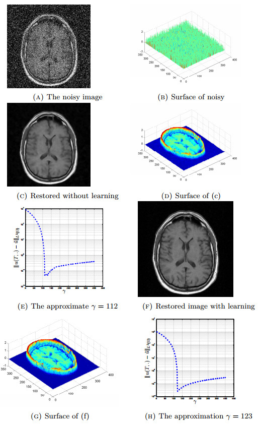A Non Convex Non Smooth Bi Level Parameter Learning For Impulse And Gaussian Noise Mixture Removing