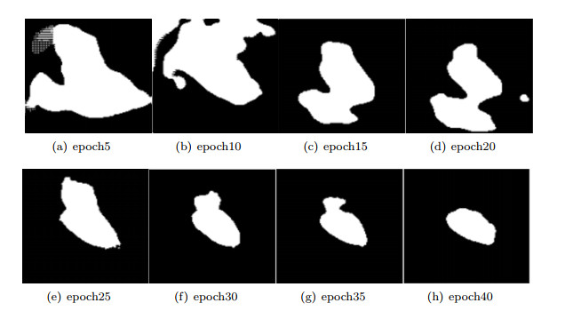 A distance function based cascaded neural network for accurate polyps segmentation and ...