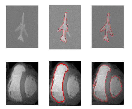 Efficient convex region-based segmentation for noising and inhomogeneous patterns