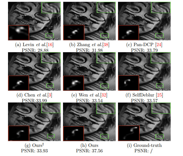 Self-supervised multi-scale neural network for blind deblurring
