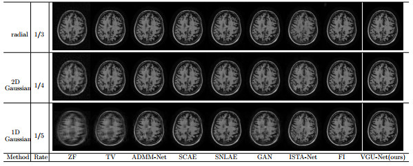 Vision graph U-Net: Geometric learning enhanced encoder for medical ...