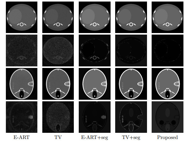 Superiorized iteration algorithm for CT image simultaneous ...