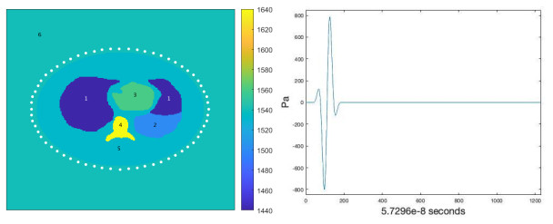 Regularized full waveform inversion for low frequency ultrasound tomography with a structural ...