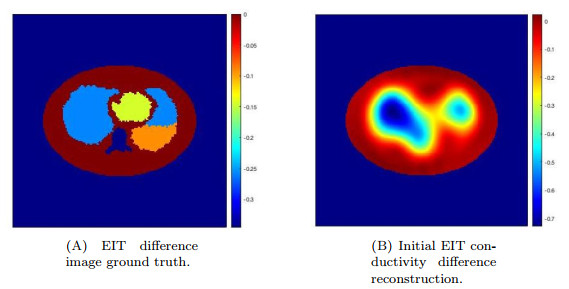 Regularized full waveform inversion for low frequency ultrasound ...