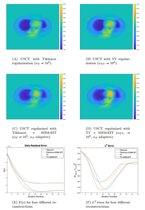 Regularized full waveform inversion for low frequency ultrasound tomography with a structural ...