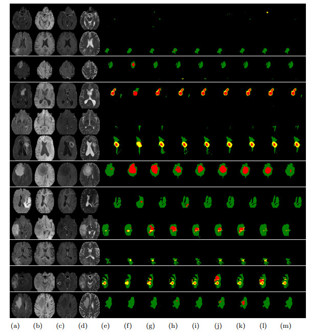 Vision graph U-Net: Geometric learning enhanced encoder for medical ...