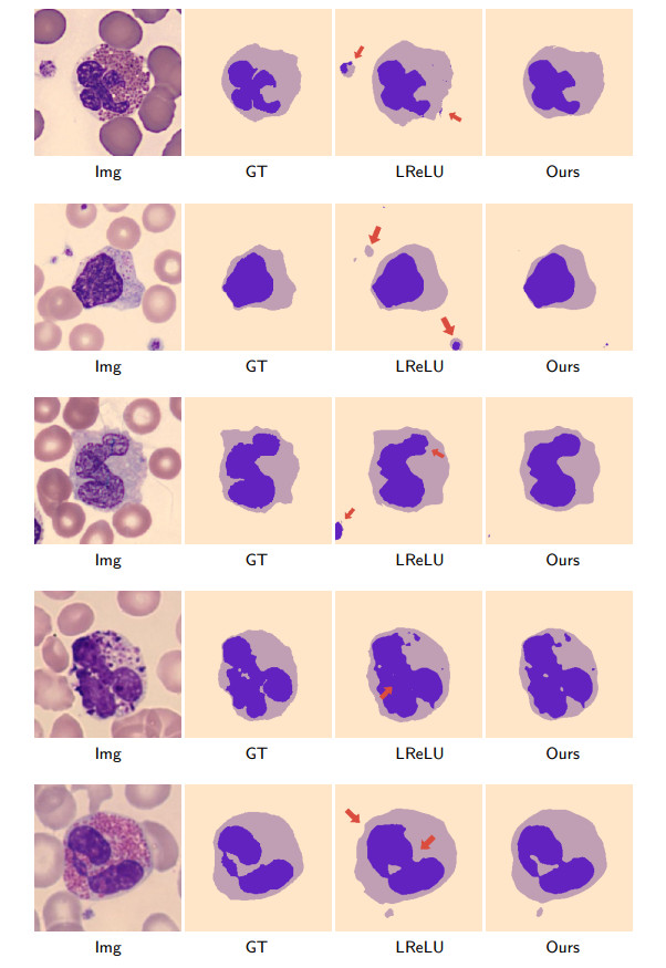 Spatially regularized Leaky ReLU in dual space for CNN based image ...