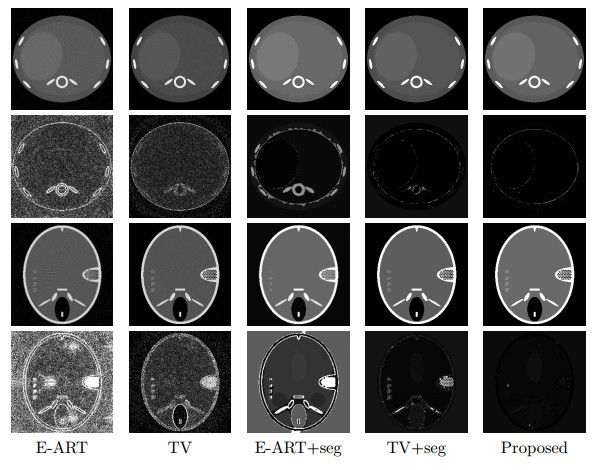 Superiorized iteration algorithm for CT image simultaneous reconstruction and segmentation