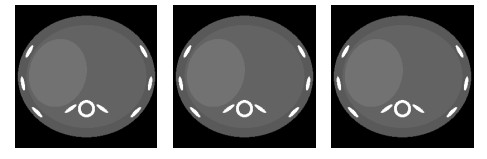 Superiorized iteration algorithm for CT image simultaneous reconstruction and segmentation
