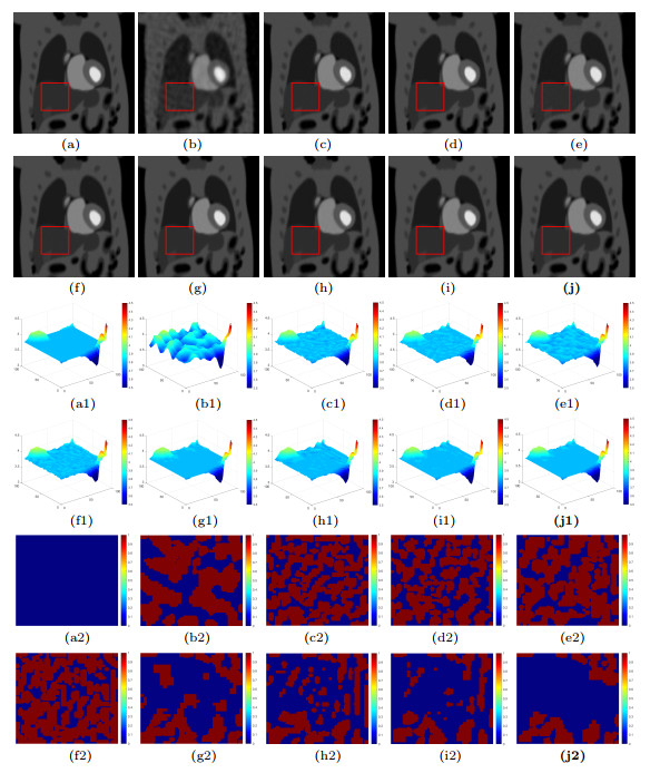 Dynamic MRI reconstruction via weighted nuclear norm and total variation regularization