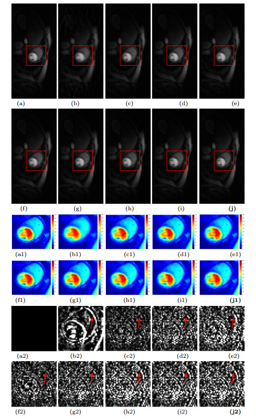 Dynamic MRI reconstruction via weighted nuclear norm and total variation regularization