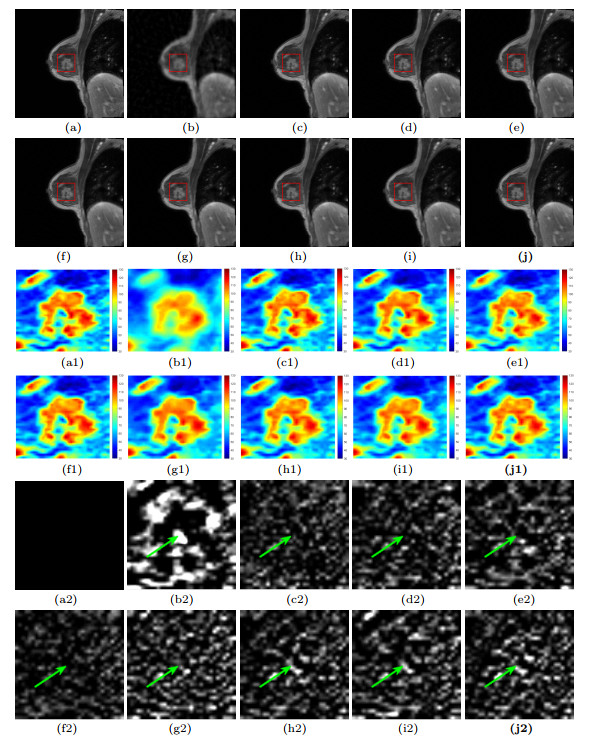 Dynamic MRI reconstruction via weighted nuclear norm and total variation regularization