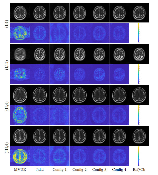 Diffusion posterior sampling for magnetic resonance imaging