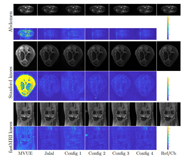 Diffusion posterior sampling for magnetic resonance imaging