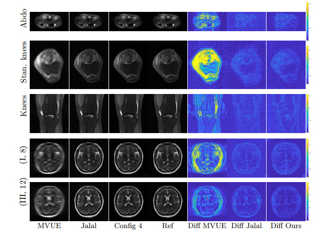Diffusion posterior sampling for magnetic resonance imaging