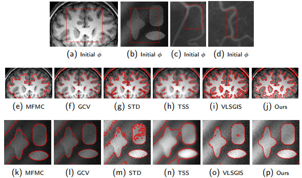 A variational image segmentation model with intensity correction in the presence of high level ...