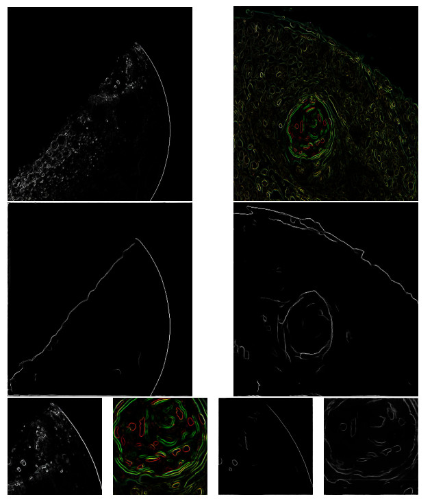 Edge detection based on variational regularization for mixed noise removal