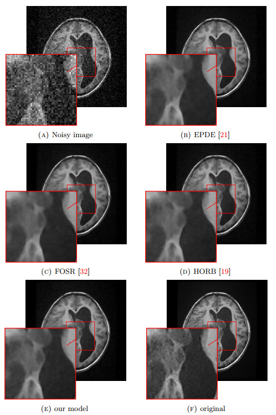 Optimization constraints and Practical Implementations of a Stochastic Primal-Dual Fixed-Point ...