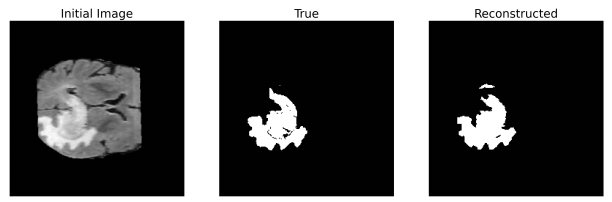 A kinetic approach to consensus-based segmentation of biomedical images