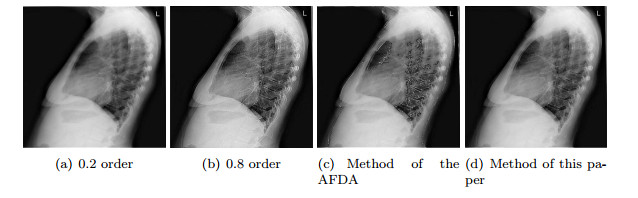 Image enhancement algorithm using adaptive fractional differential mask technique