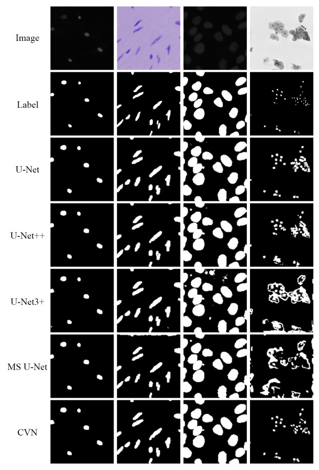 A trainable variational Chan-Vese network based on algorithm unfolding for image segmentation