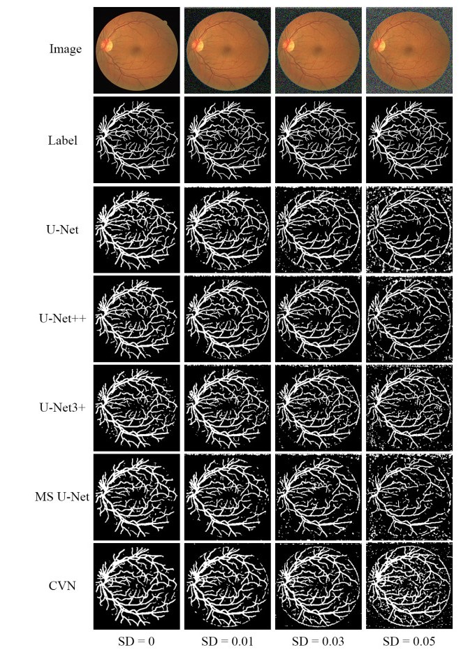 A trainable variational Chan-Vese network based on algorithm unfolding for image segmentation