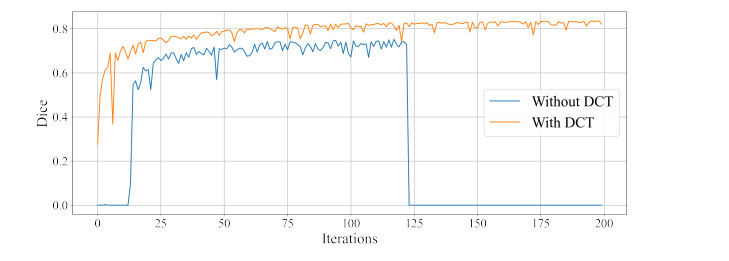 A trainable variational Chan-Vese network based on algorithm unfolding for image segmentation