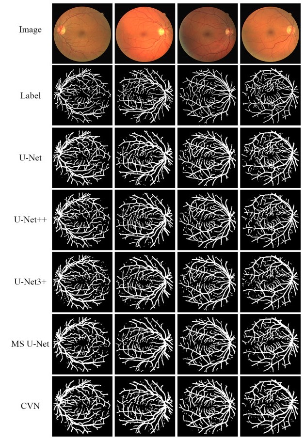 A trainable variational Chan-Vese network based on algorithm unfolding for image segmentation